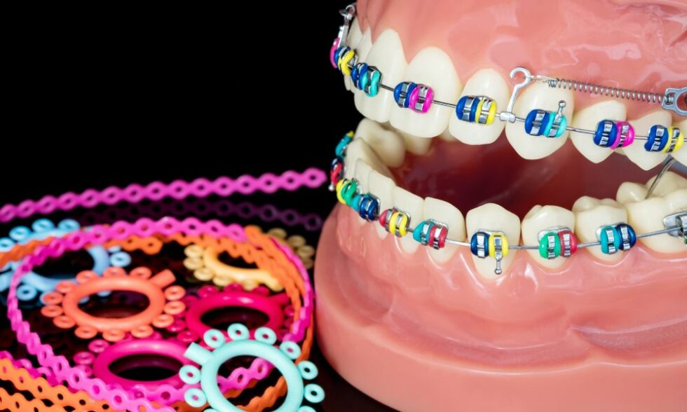 ¿Cómo Y Cada Cuánto Se Cambian Las Ligas De Los Brackets?