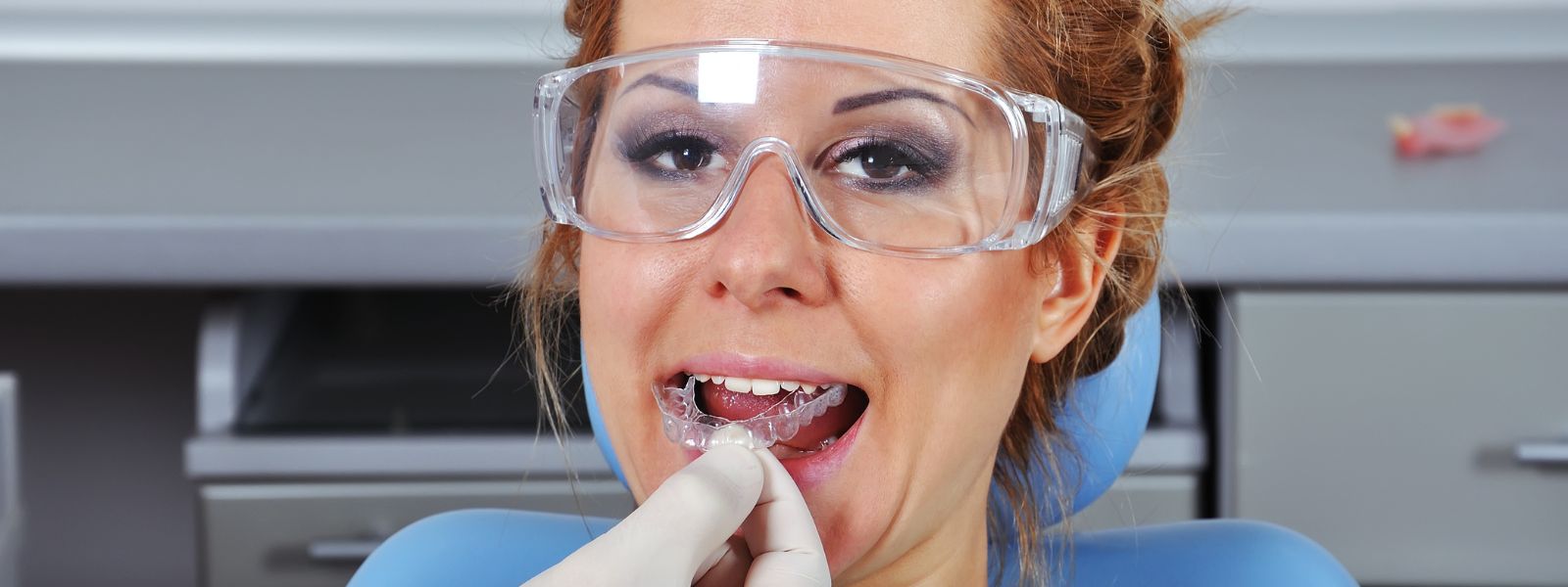 Qué Es Una Férula Dental: Guía Completa